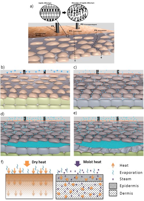 Prediction of Steam Burns Severity using Raman Spectroscopy on ex vivo ...