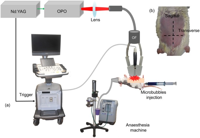 On-chip generation of microbubbles in photoacoustic contrast agents for ...
