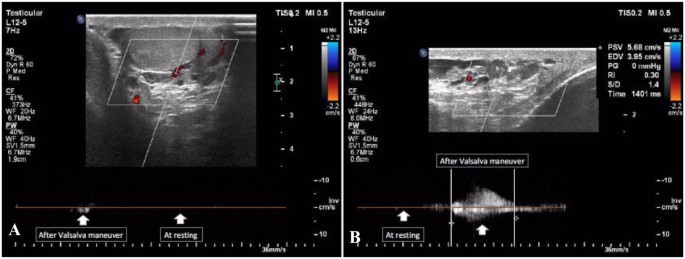 A Novel Method for Investigating the Role of Reflux Pattern in Color ...