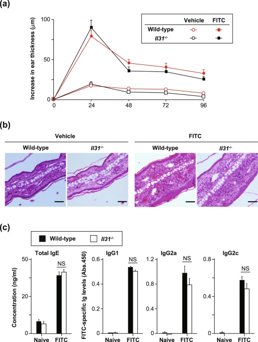 IL-31 is crucial for induction of pruritus, but not inflammation, in ...