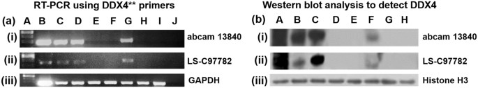 Initial characterisation of adult human ovarian cell populations ...