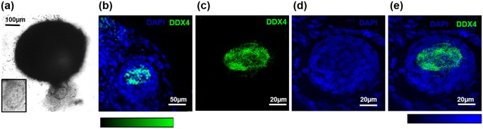 Initial characterisation of adult human ovarian cell populations ...