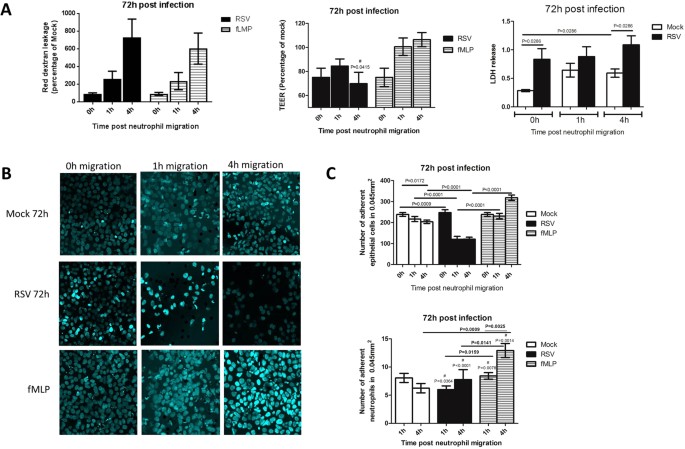 An in vitro transepithelial migration assay to evaluate the role of ...