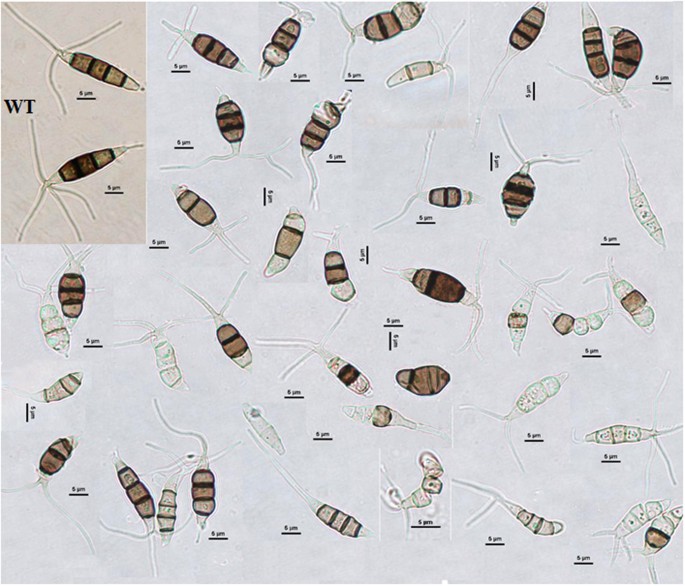 A MYST Histone Acetyltransferase Modulates Conidia Development and ...