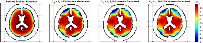 How does blood regulate cerebral temperatures during hypothermia ...