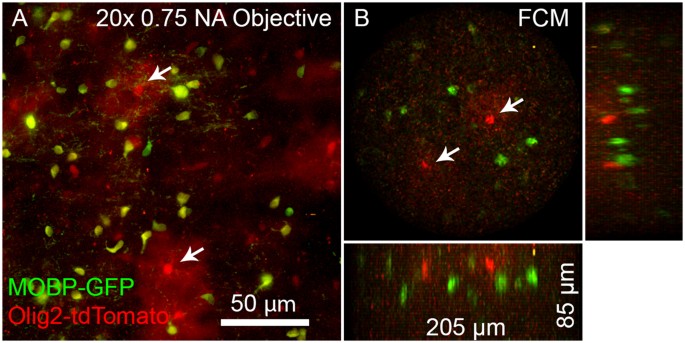 Three dimensional two-photon brain imaging in freely moving mice using ...