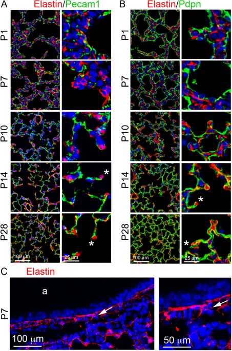 Spatial and temporal changes in extracellular elastin and laminin ...