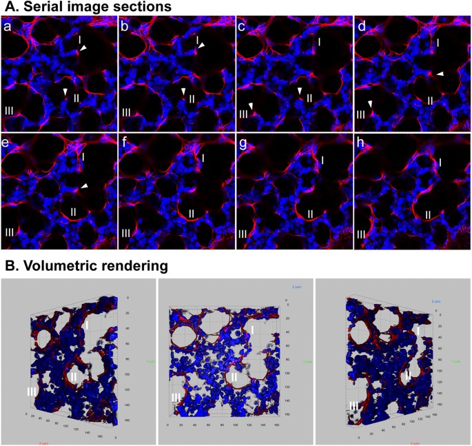 Spatial and temporal changes in extracellular elastin and laminin ...