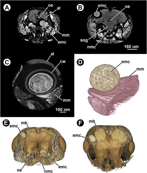 3D virtual histology at the host/parasite interface: visualisation of ...