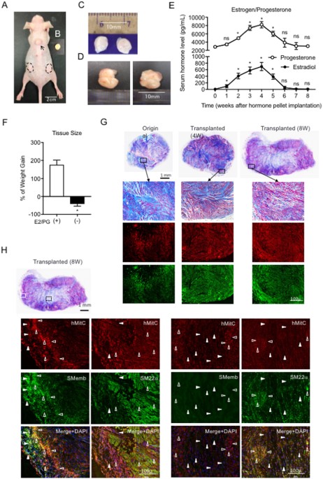 Establishment of a novel mouse xenograft model of human uterine ...