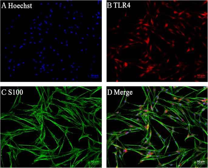 Toll-Like Receptor 4 (TLR4) Expression Affects Schwann Cell Behavior in ...