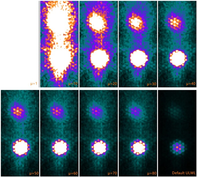 Quantification of radioactivity by planar gamma-camera images, a ...