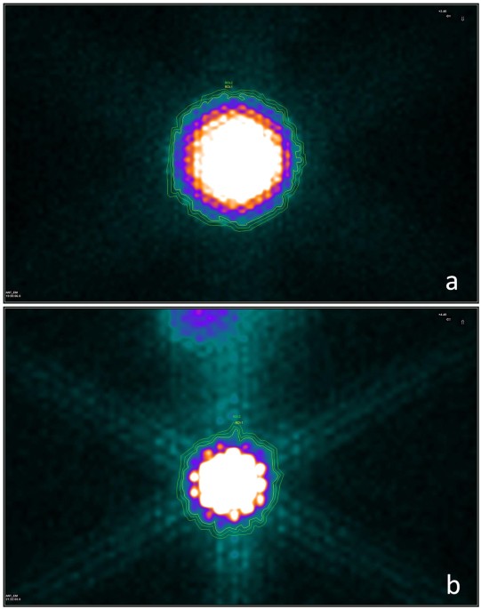 Quantification of radioactivity by planar gamma-camera images, a ...
