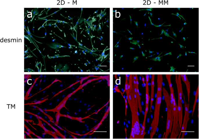 Human tissue-engineered skeletal muscle: a novel 3D in vitro model for ...