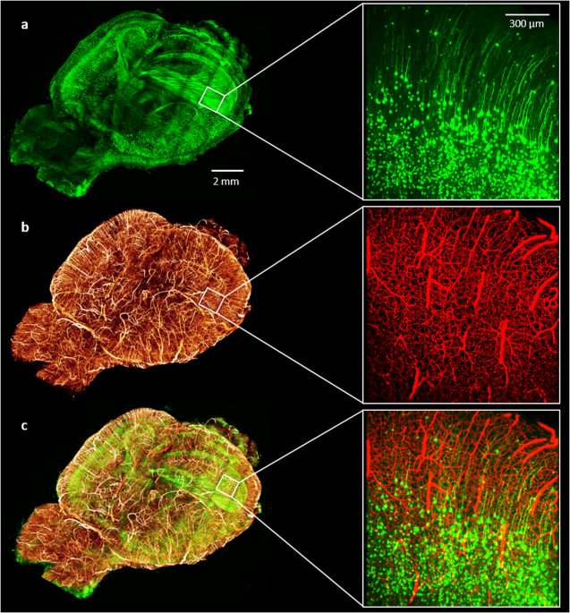 Whole-Brain Vasculature Reconstruction at the Single Capillary Level ...