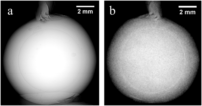 Characterizing pearls structures using X-ray phase-contrast and neutron ...