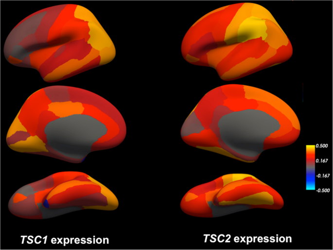 Regionally specific TSC1 and TSC2 gene expression in tuberous sclerosis ...