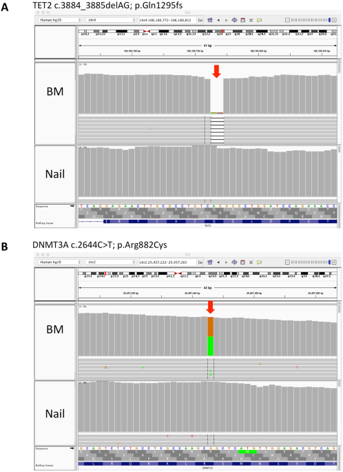 Efficient identification of somatic mutations in acute myeloid ...