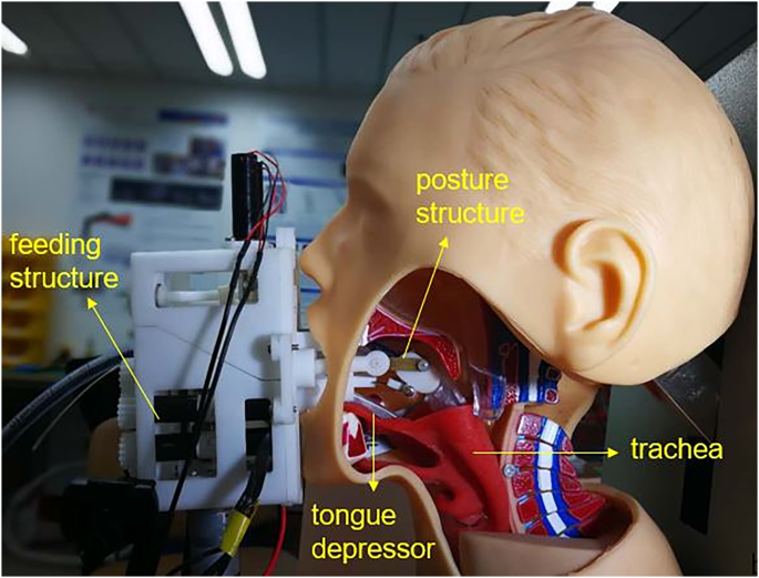 An original design of remote robot-assisted intubation system ...