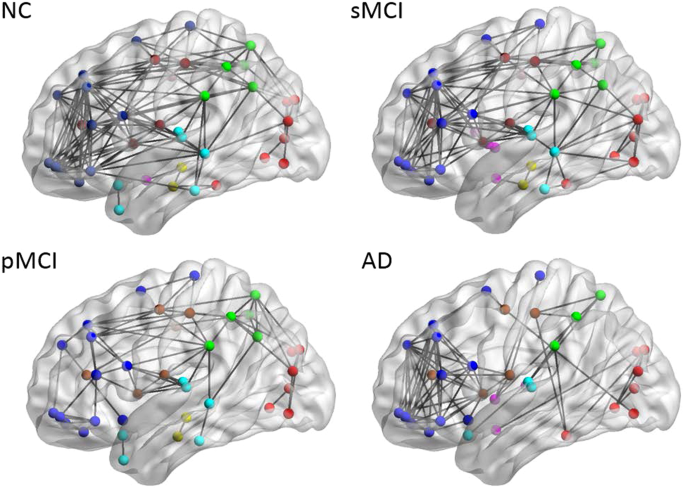 Characteristic patterns of inter- and intra-hemispheric metabolic connectivity in patients with ...