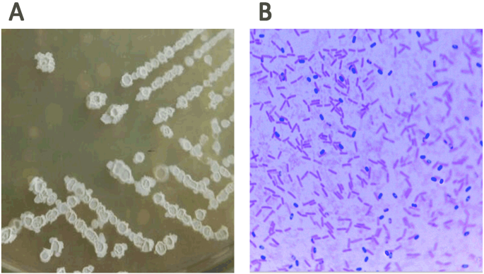 Bacillus velezensis A2 fermentation exerts a protective effect on renal ...