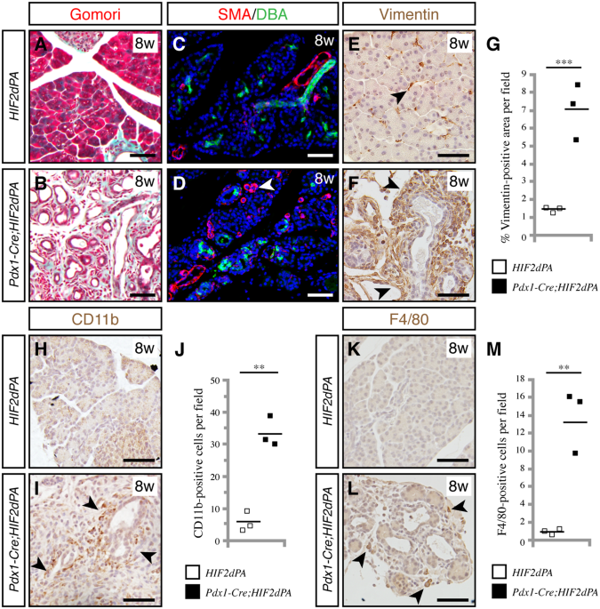 Stabilization of HIF-2α impacts pancreas growth | Scientific Reports