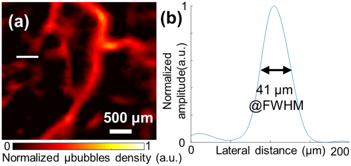 Super-resolution ultrasound imaging method for microvasculature in vivo ...