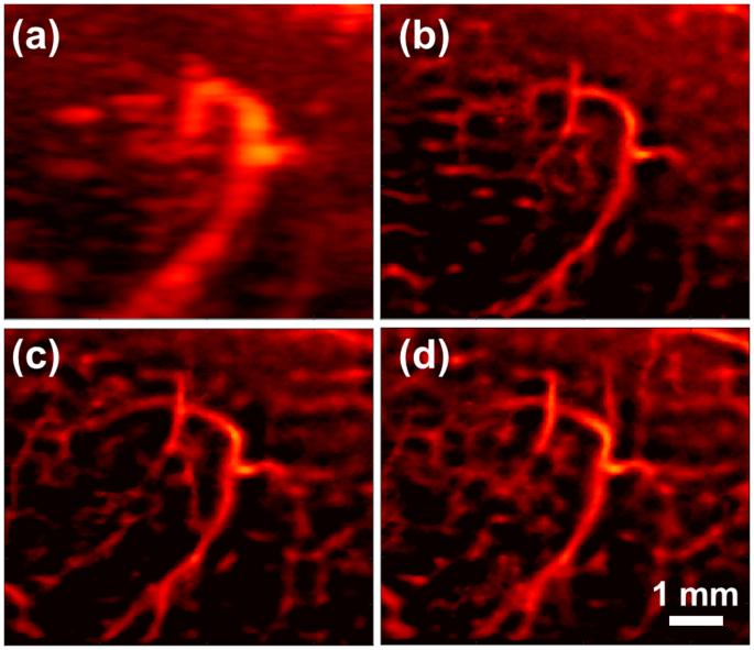 Super-resolution ultrasound imaging method for microvasculature in vivo ...