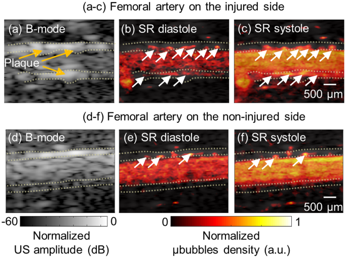 Super-resolution ultrasound imaging method for microvasculature in vivo ...