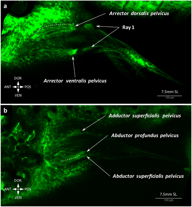 Development of zebrafish paired and median fin musculature: basis for ...