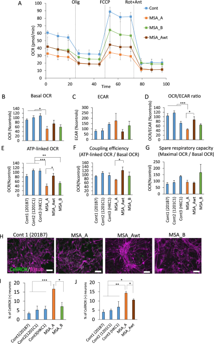 The pathogenesis linked to coenzyme Q10 insufficiency in iPSC-derived ...