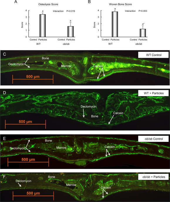 Leptin Increases Particle-Induced Osteolysis in Female ob/ob Mice ...