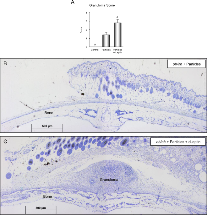 Leptin Increases Particle-Induced Osteolysis in Female ob/ob Mice ...