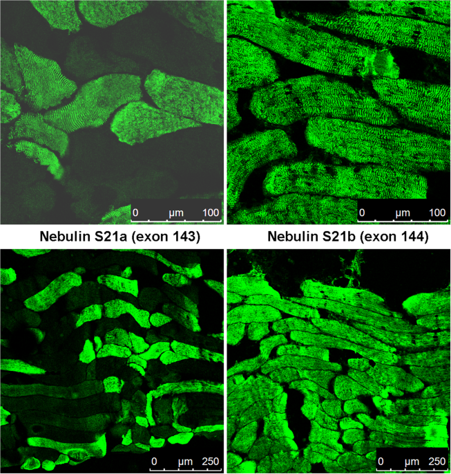 Two alternatively-spliced human nebulin isoforms with either exon 143 ...