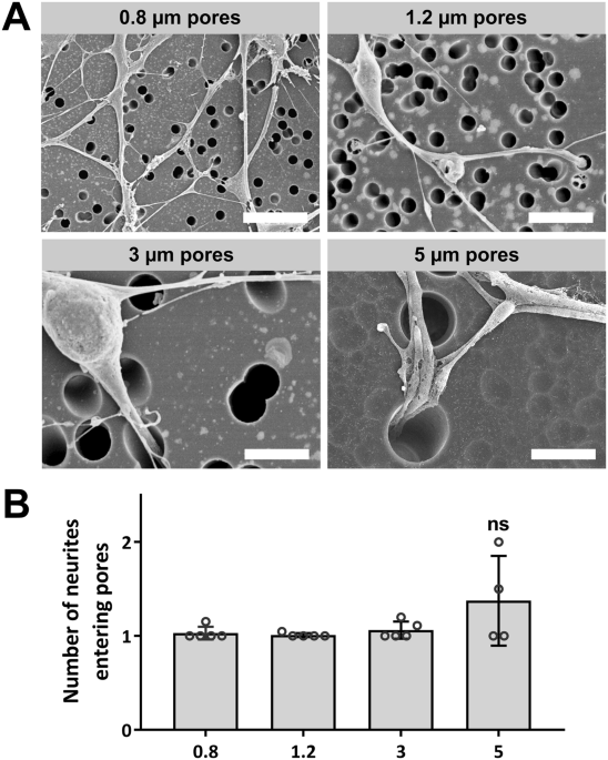 A closer look at neuron interaction with track-etched microporous ...