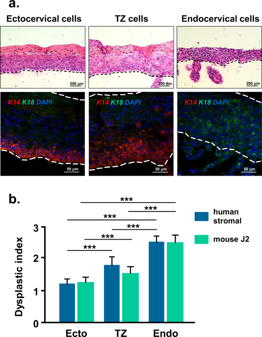 HPV16-Immortalized Cells from Human Transformation Zone and Endocervix ...