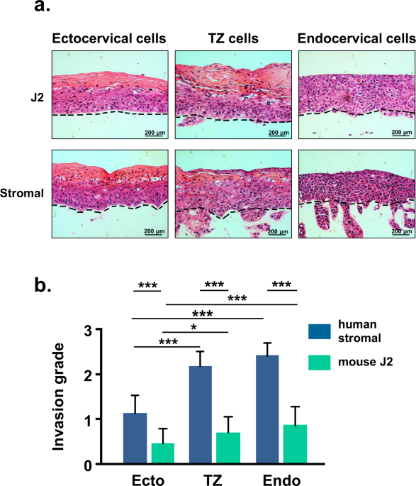 HPV16-Immortalized Cells from Human Transformation Zone and Endocervix ...