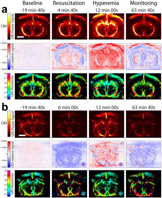 Multi-parametric functional ultrasound imaging of cerebral hemodynamics ...