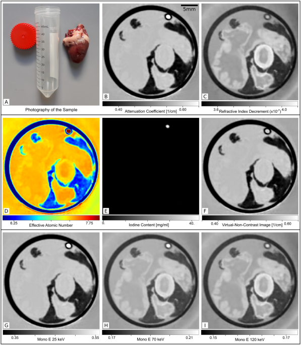 Direct quantitative material decomposition employing grating-based X ...