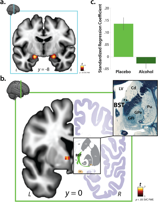 Acute alcohol administration dampens central extended amygdala ...