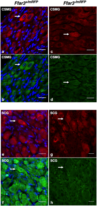 Selective tracking of FFAR3-expressing neurons supports receptor ...