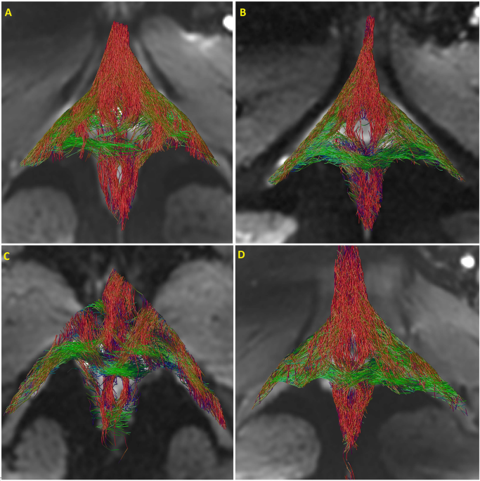 Connectivity of the Superficial Muscles of the Human Perineum: A ...