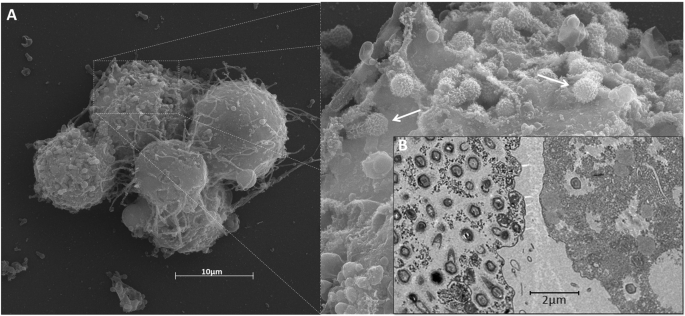 Tupanvirus-infected amoebas are induced to aggregate with uninfected ...