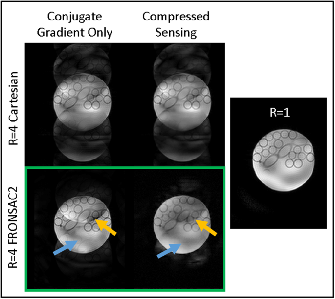 Clinical Potential of a New Approach to MRI Acceleration | Scientific ...