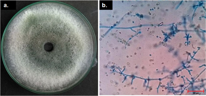 A new application of Trichoderma asperellum as an anopheline larvicide for eco friendly ...