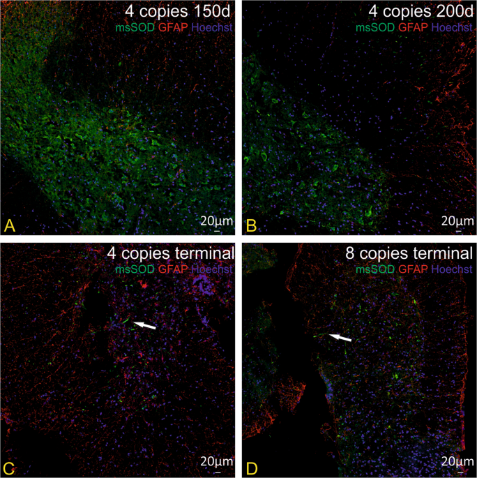 SOD1/Rag2 Mice with Low Copy Number of SOD1 Gene as a New Long-Living ...