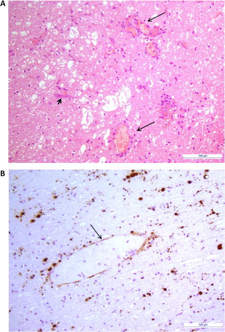 Diagnosis and characterization of canine distemper virus through ...