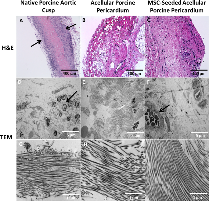 In Vivo Response of Acellular Porcine Pericardial for Tissue Engineered ...