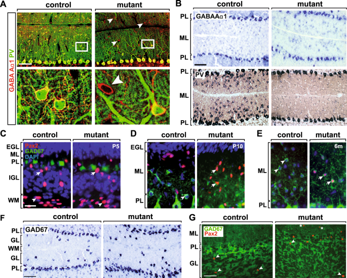 NeuroD2 controls inhibitory circuit formation in the molecular layer of ...