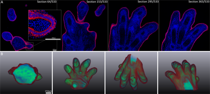 Immunofluorescence Tomography: High-resolution 3-D reconstruction by ...
